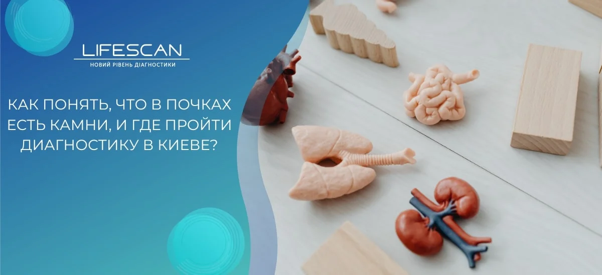 Камни в почках: симптомы и современная диагностика (УЗИ и КТ) | LifeScan